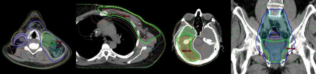 cropped-zzzz-full.jpg – DOSEPEDIA